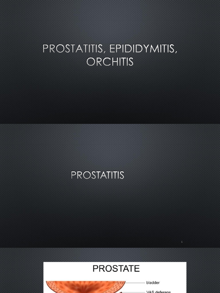 Dr. Budi - PROSTATITIS, EPIDIDIMITIS, DAN ARCHITIS | PDF | Urinary ...