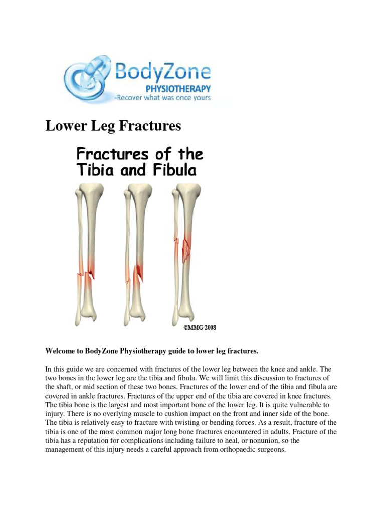 Lower Leg Fractures: Tibia & Fibula Guide | PDF | Physical Therapy | Knee