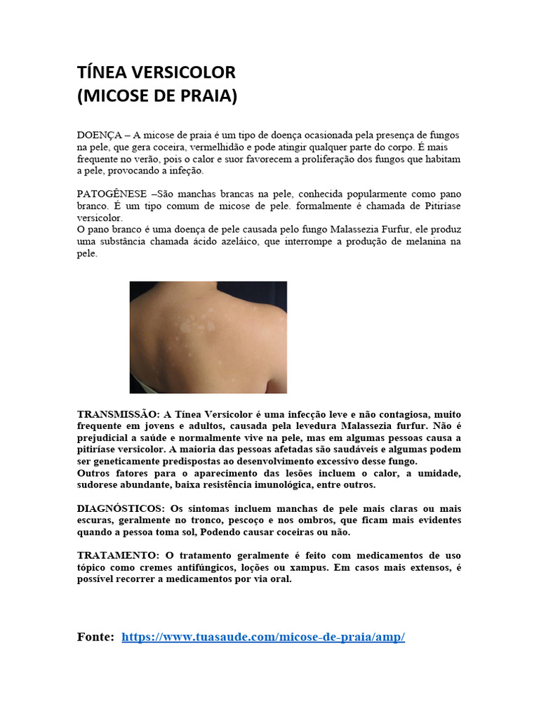 Tínea Versicolor | PDF