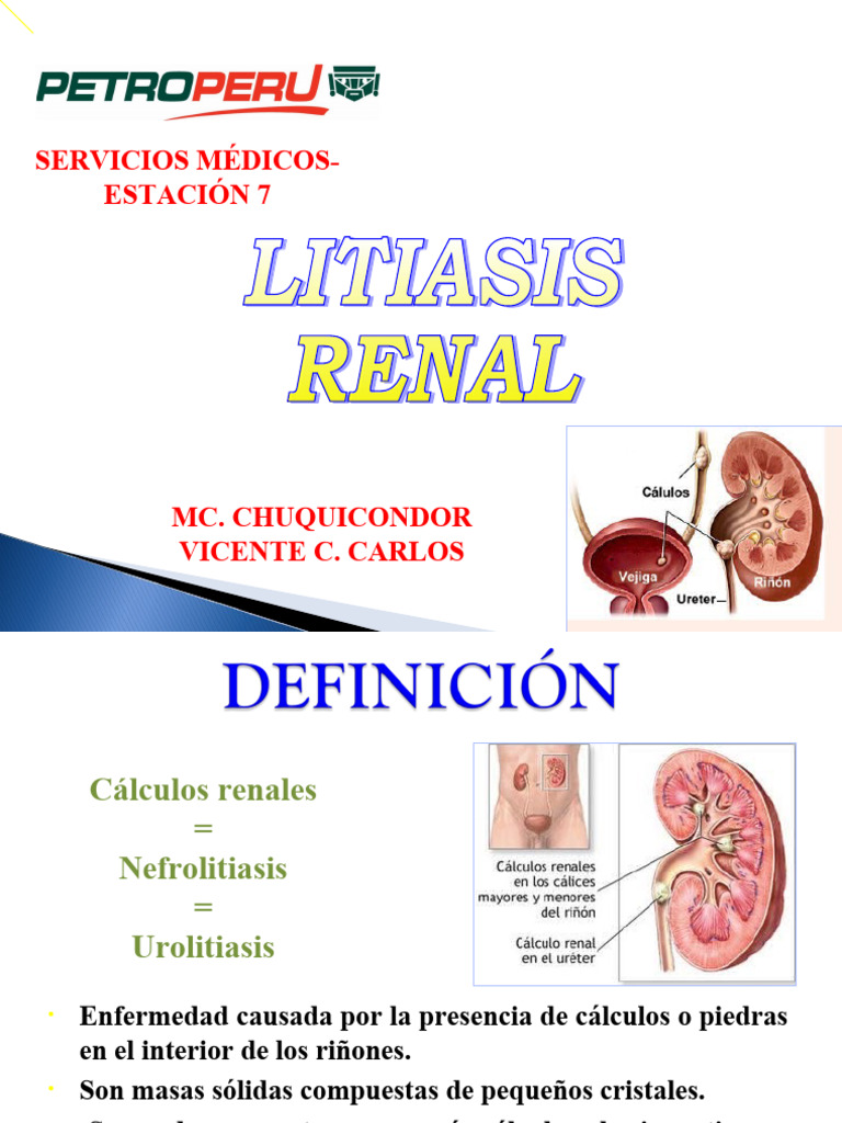 Litiasis Renal | PDF | Especialidades Medicas | Medicina CLINICA