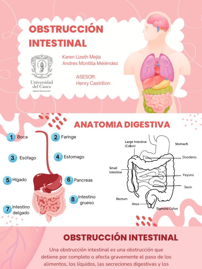 Obstrucción Intestinal Pdf Medicamentos Con Receta Estreñimiento