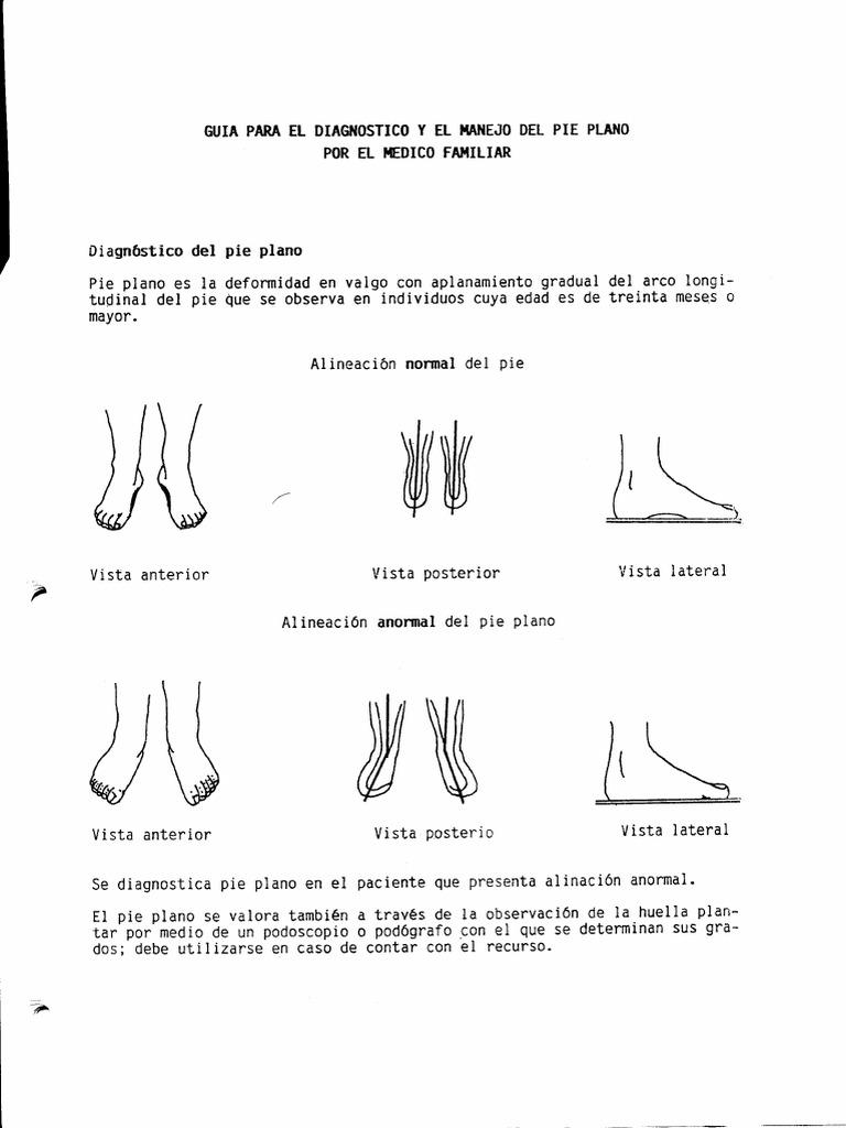 Guía para el Manejo del Pie Plano | PDF | Pie | Especialidades Medicas