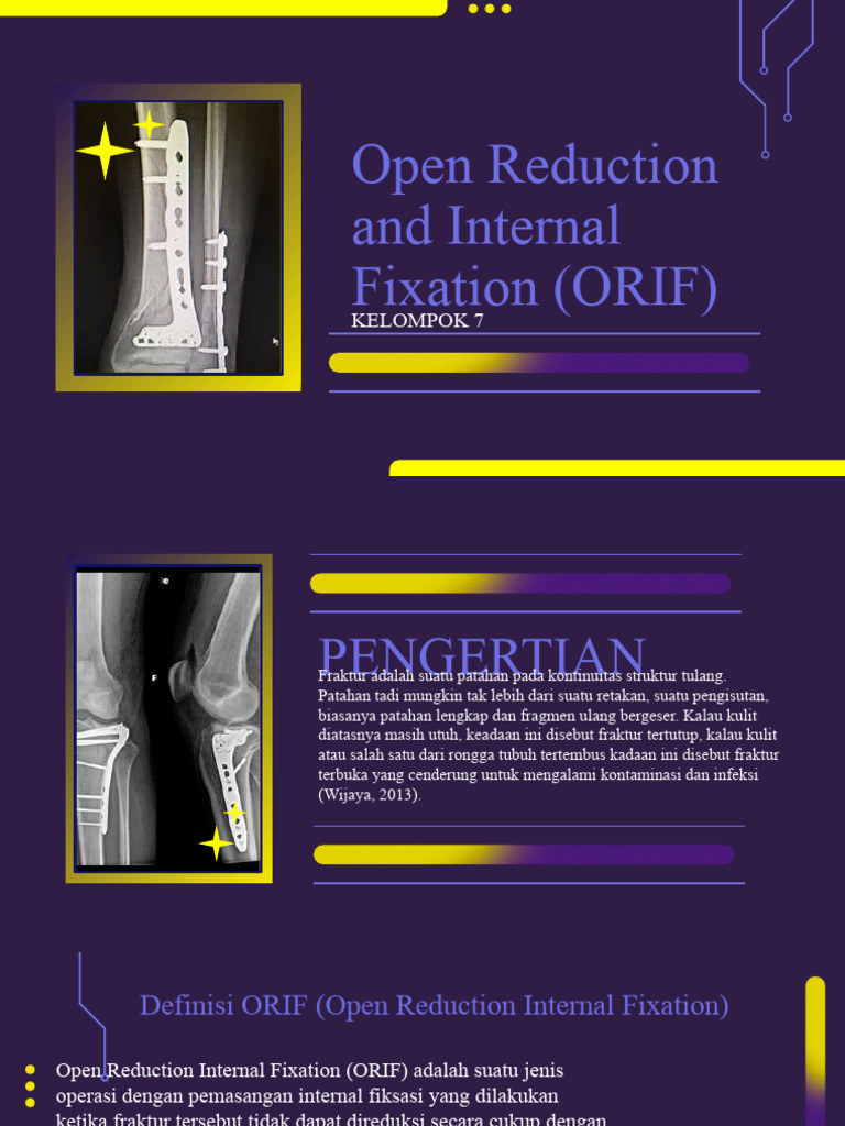Kelompok 6 Orif by Nina | PDF