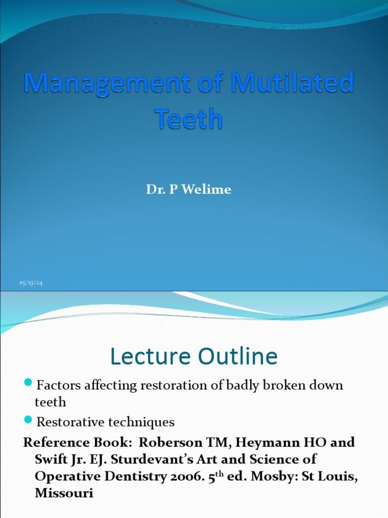 Restoring Badly Broken Down Teeth | PDF | Human Tooth | Dentistry