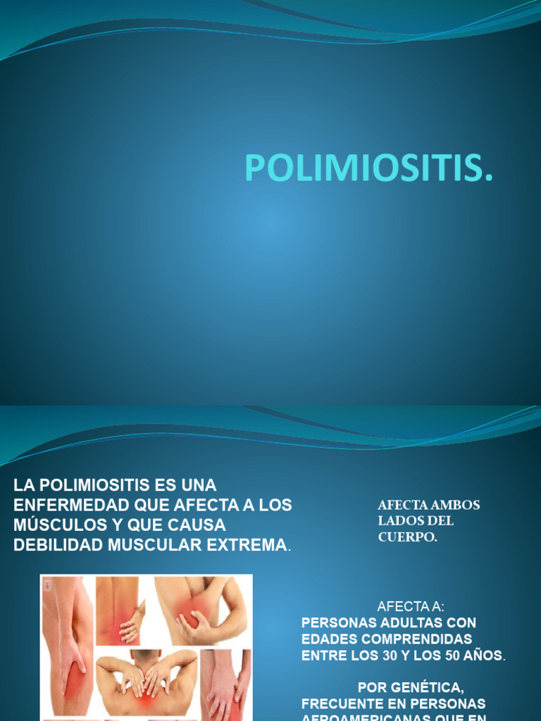 POLIMIOSITIS | PDF | Medicina CLINICA | Causas de la muerte