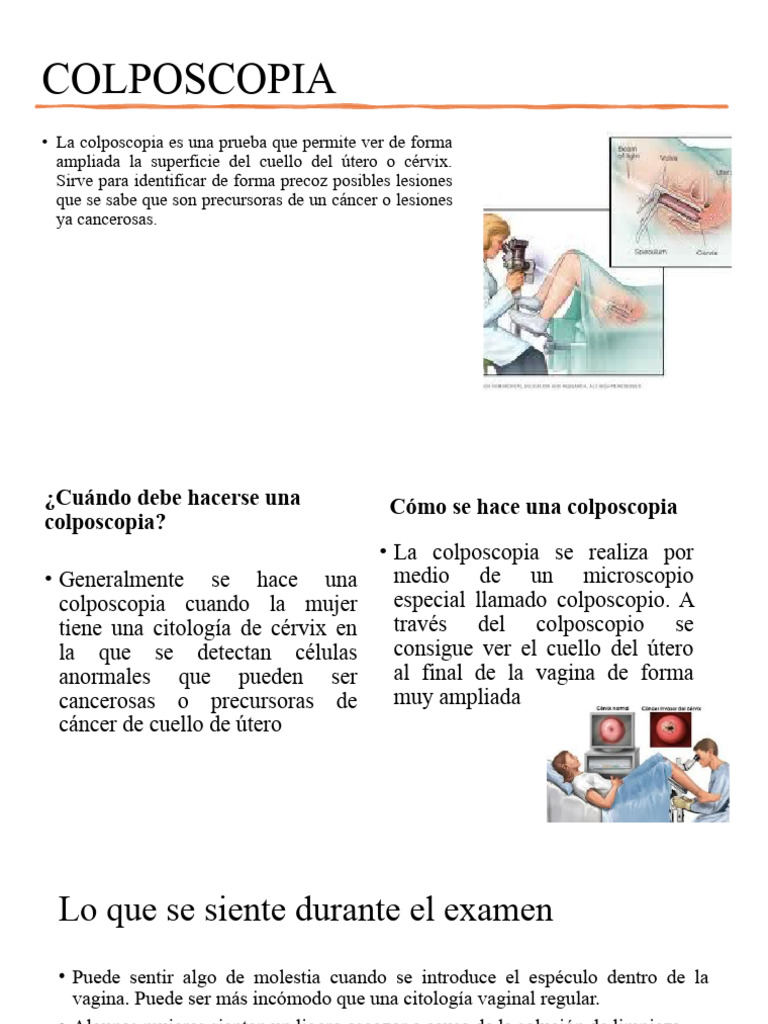 Colposcopia: Detección y Procedimiento | PDF | Vagina | Cáncer de ...