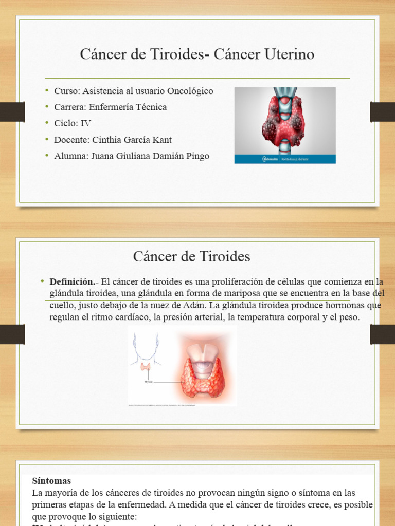 Cáncer de Tiroides: Síntomas y Tratamientos | PDF | Cáncer | Cáncer de ...