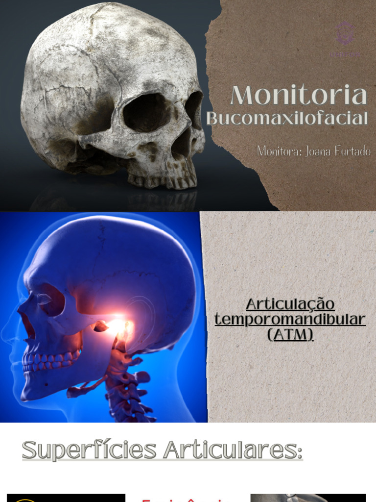 Articulação Temporomandibular (ATM) - 240327 - 233906 | PDF | Cabeça e ...