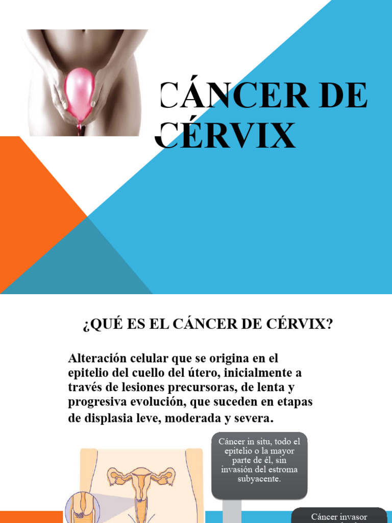 Cancer de Cervix (1) Final | PDF | Cáncer de cuello uterino | Especialidades Medicas