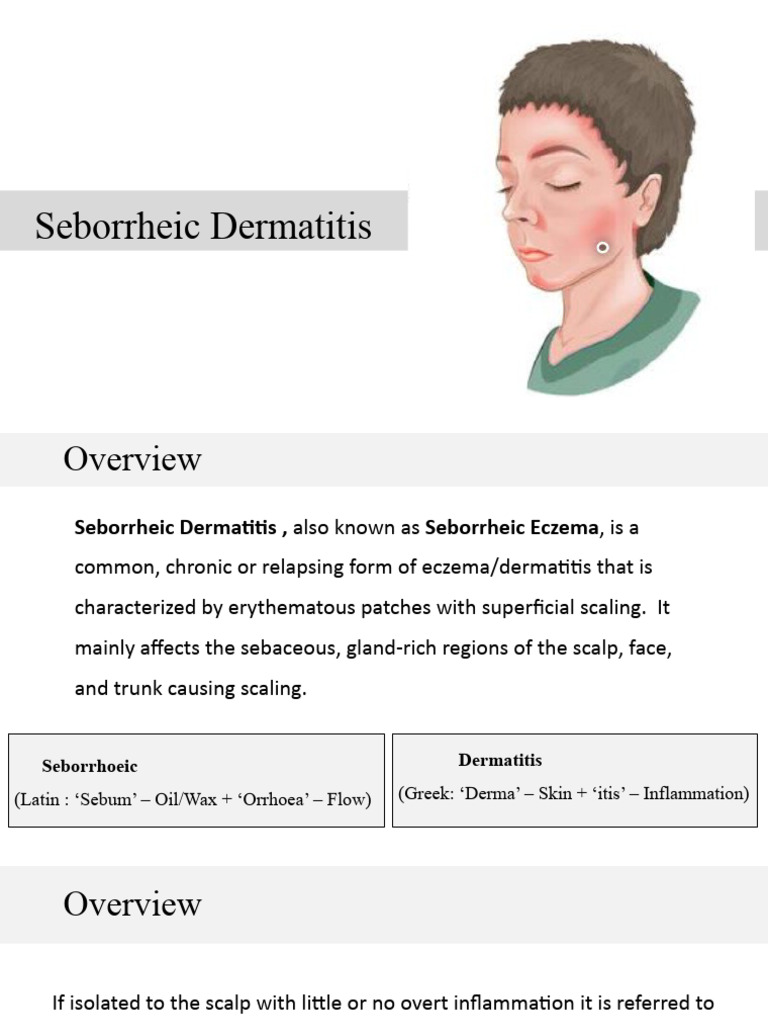 Seborrheic Dermatitis | PDF | Dermatitis | Medical Specialties