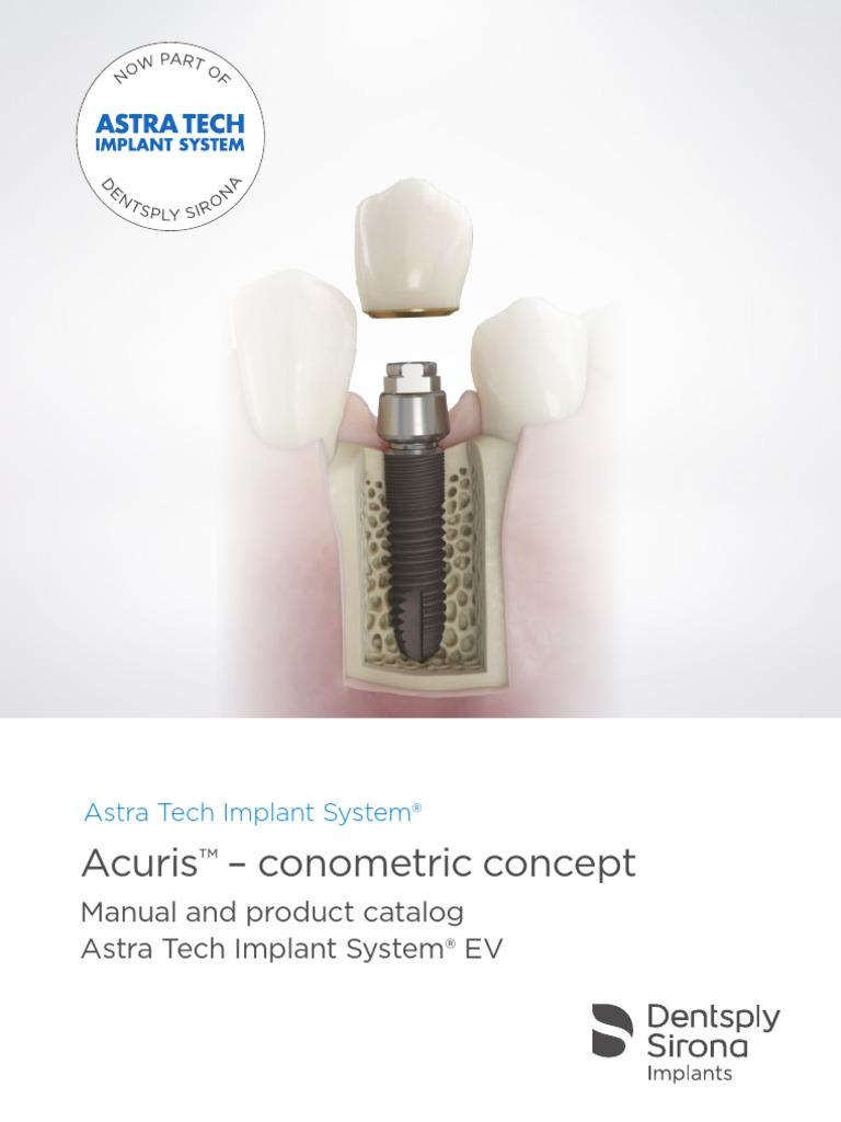 Auiris Abutment for Astra Implant | PDF | Dental Implant | Dentistry ...