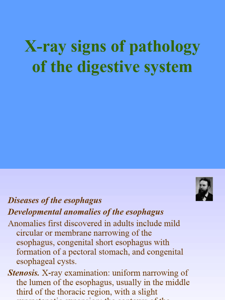 X-Ray Signs of Gastrointestinal Pathology | PDF | Esophagus | Stomach