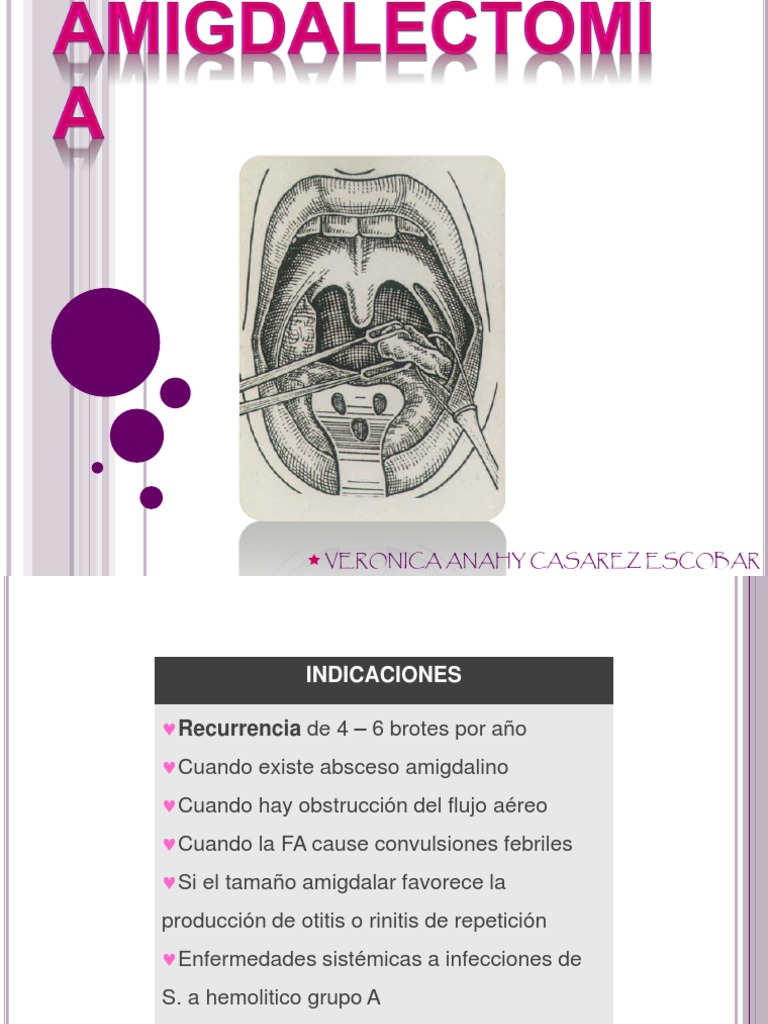 AMIGDALECTOMÍA | PDF