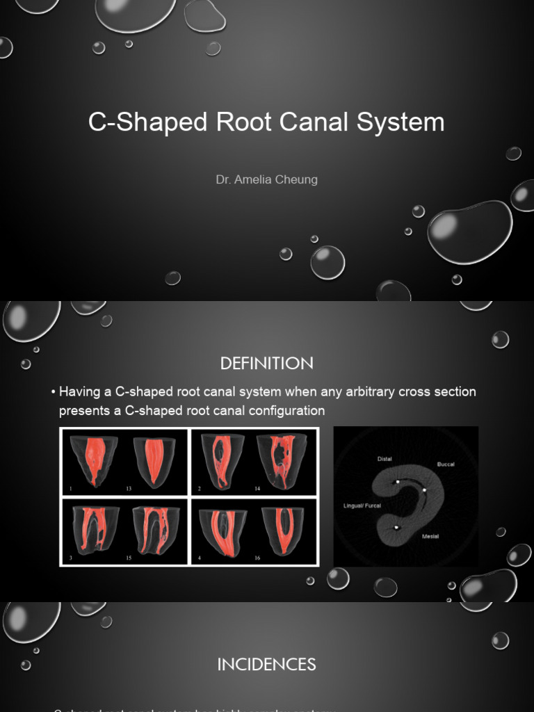C-Shaped Root Canal System | PDF | Dental Anatomy | Tooth