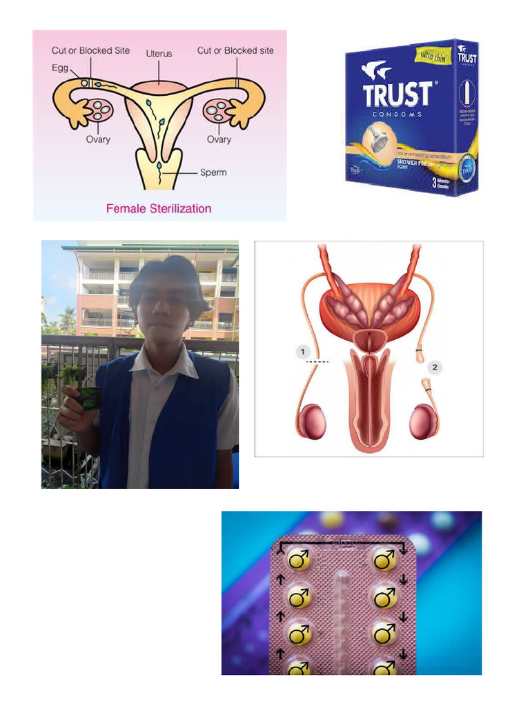 What is Family Planning | PDF | Birth Control | Family Planning