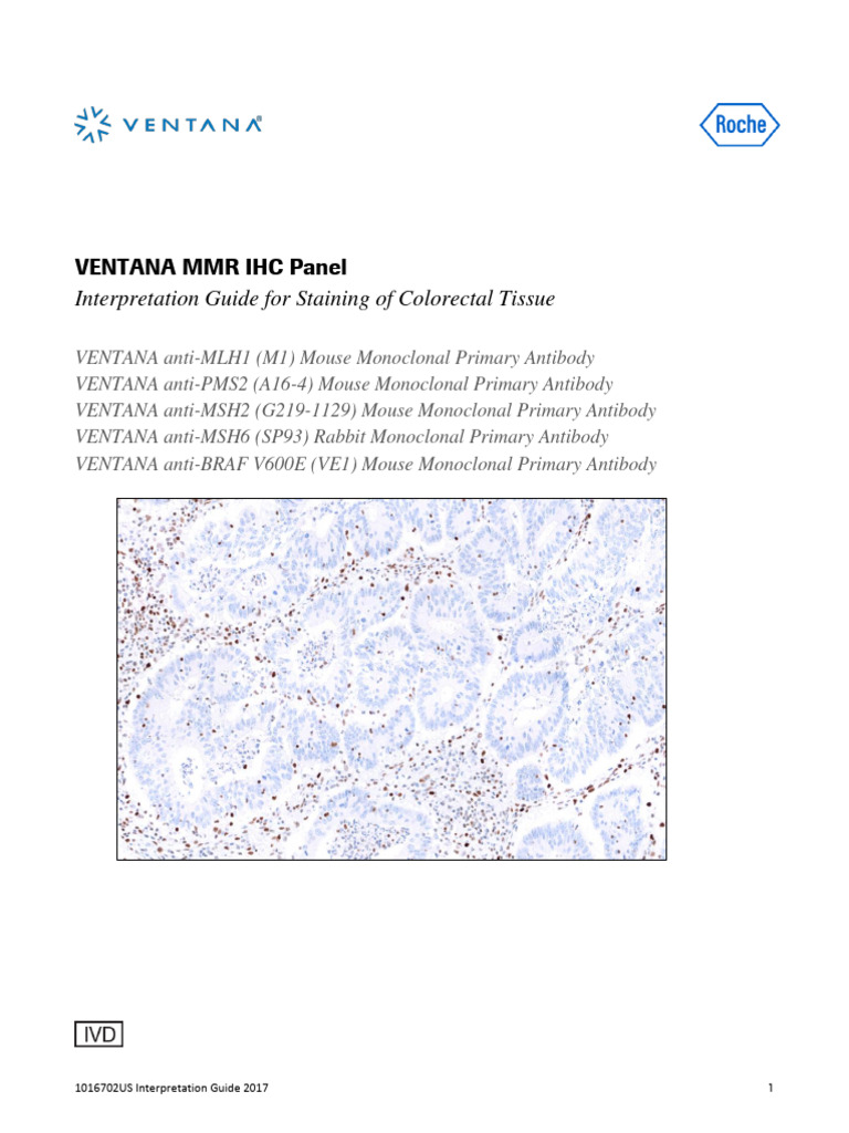 MMR IHC Panel InterpretationGuide | PDF | Immunohistochemistry ...