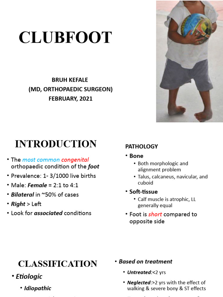 Clubfoot | Download Free PDF | Human Diseases And Disorders ...