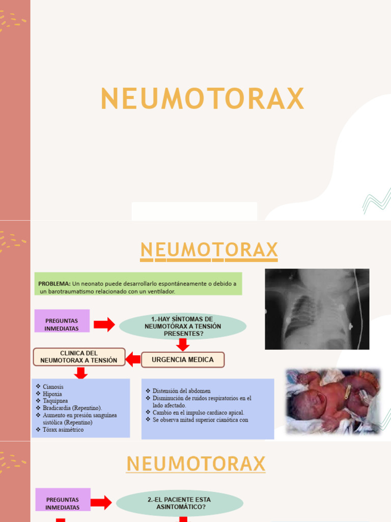 Neu Motor Ax | PDF | Neumología | Emergencias Médicas