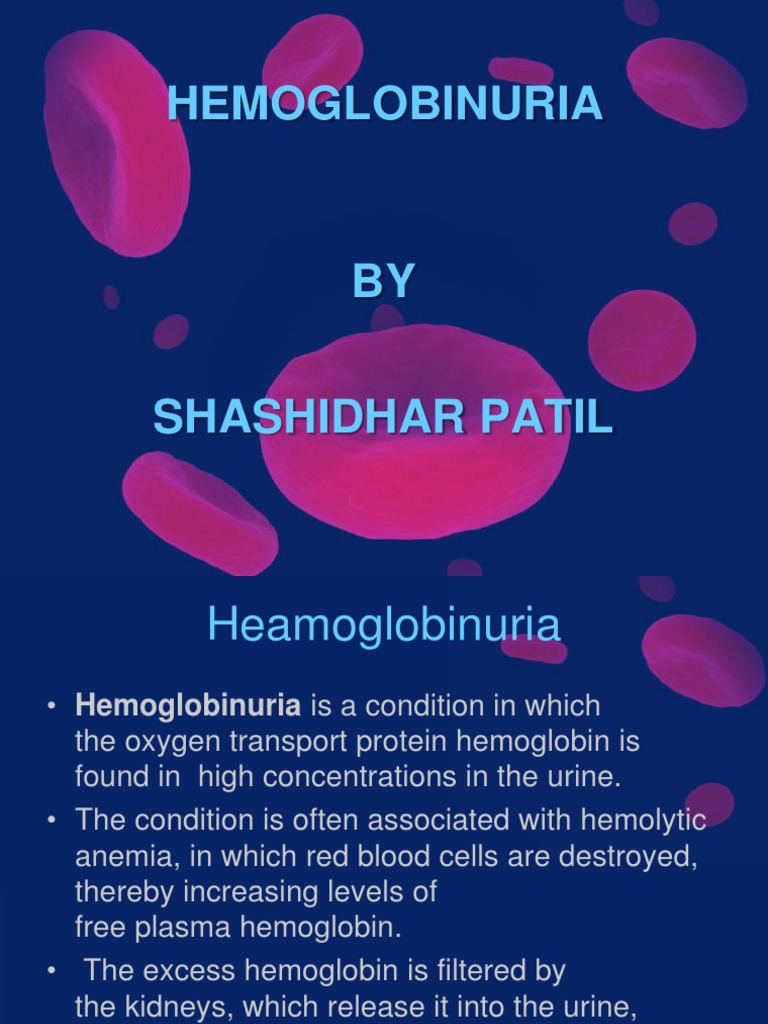 Hemoglobinuria | PDF | Complement System | Anemia