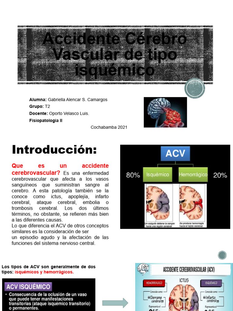 Accidente Cerebrovascular Isquémico: Causas y Efectos | PDF | Carrera ...