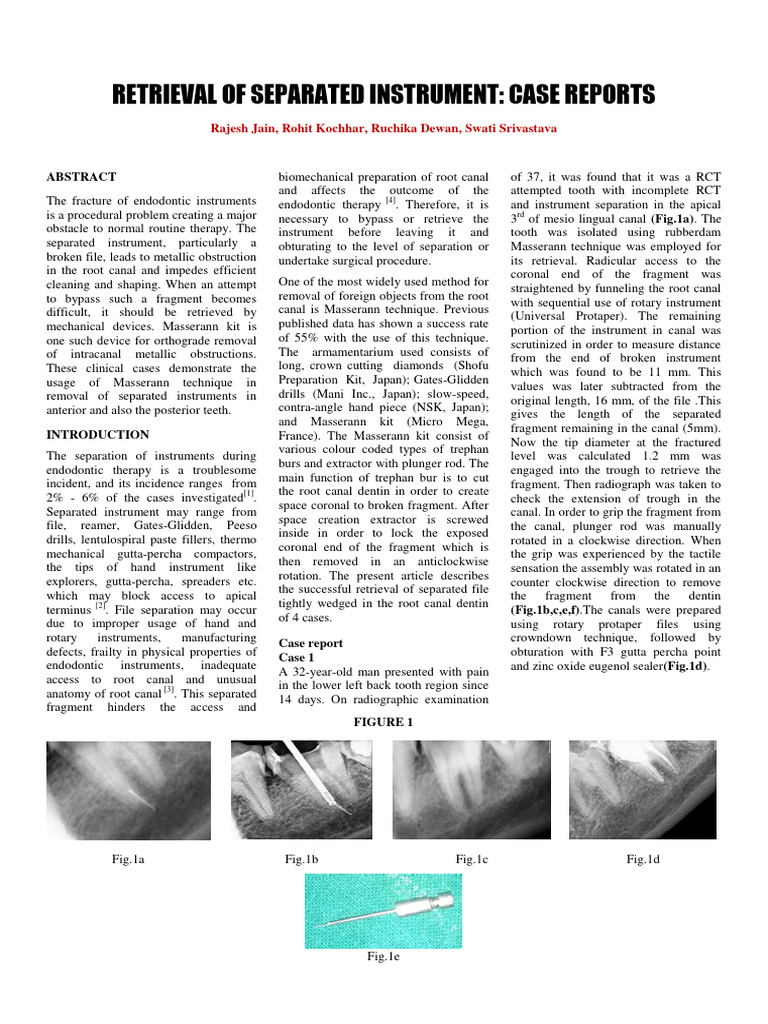 Retrieval of Separated Instrument: Case Reports | PDF | Dentistry | Mouth