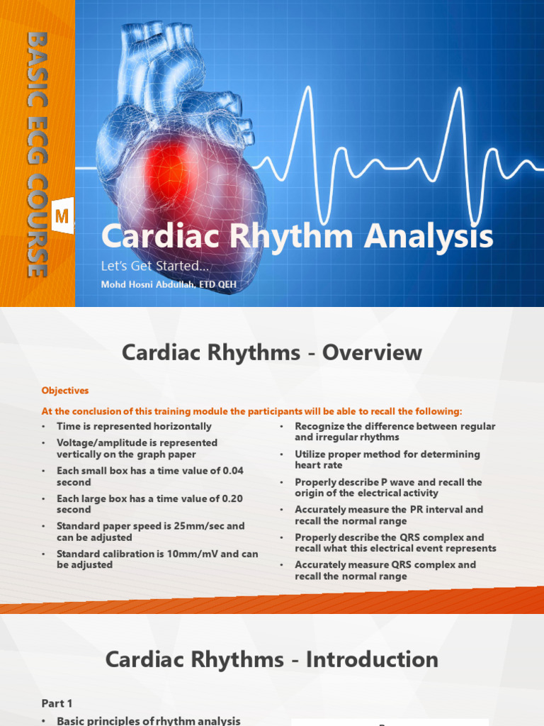 Cardiac Rhythm Analysis | PDF | Electrocardiography | Heart
