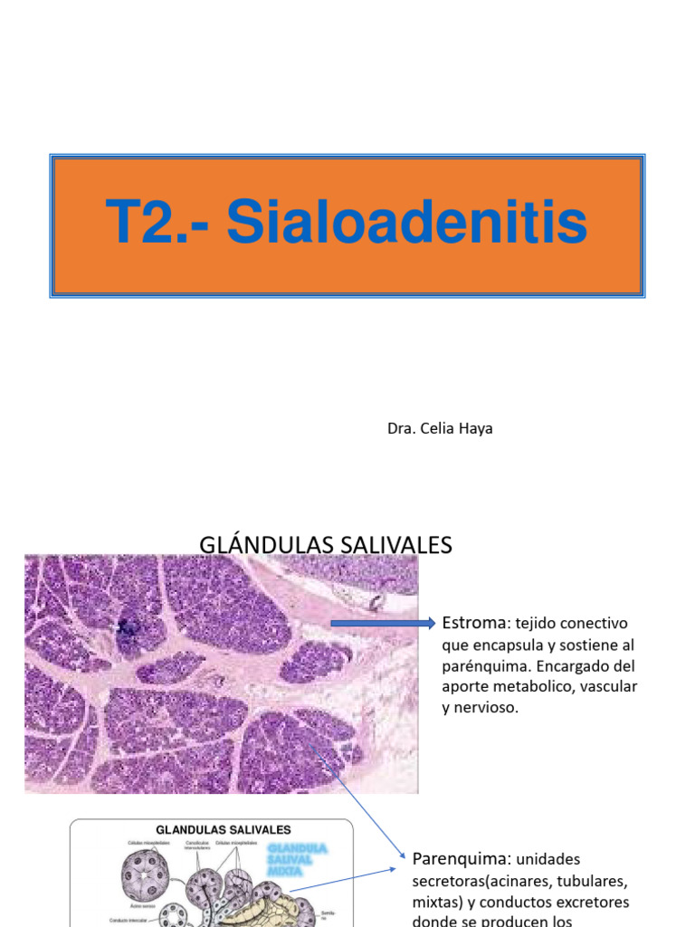 Sialoadenitis: Tipos y Tratamientos | PDF | Causas de la muerte ...