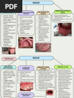 Condiloma Acuminado Oral y VPH | PDF | Epitelio | Especialidades Medicas