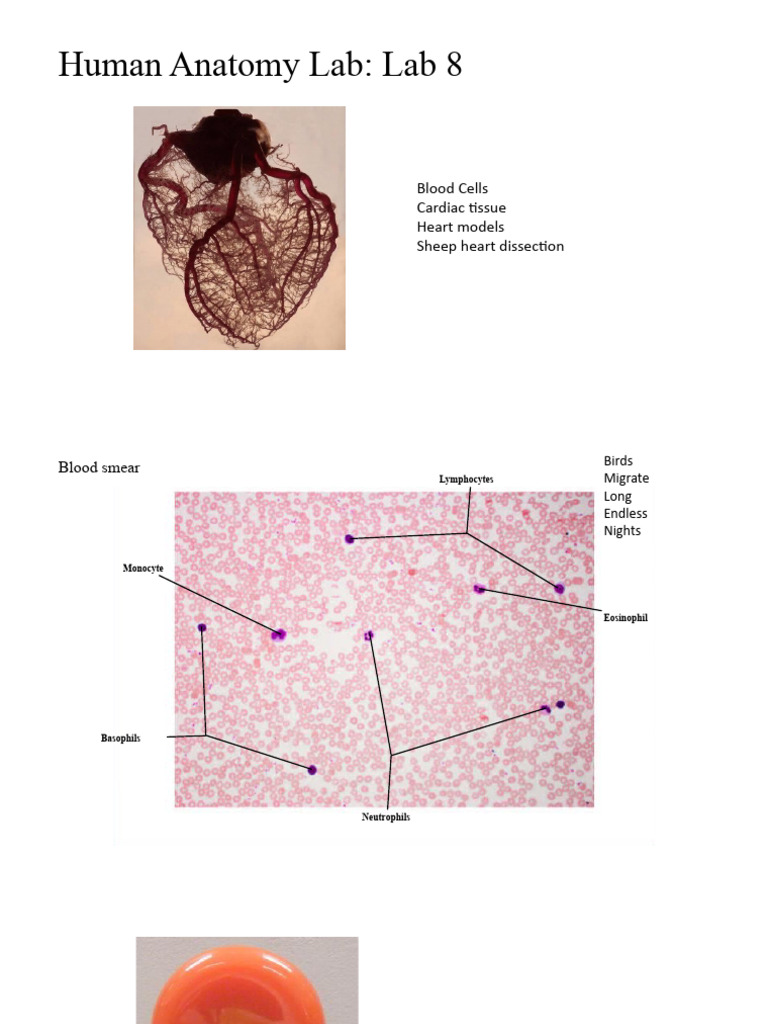 Lab 8 Blood and Heart Anatomy | PDF | Heart Valve | Heart