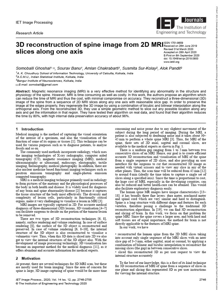 IET Image Processing - 2020 - Ghoshal - 3D Reconstruction of Spine Image From 2D MRI Slices ...