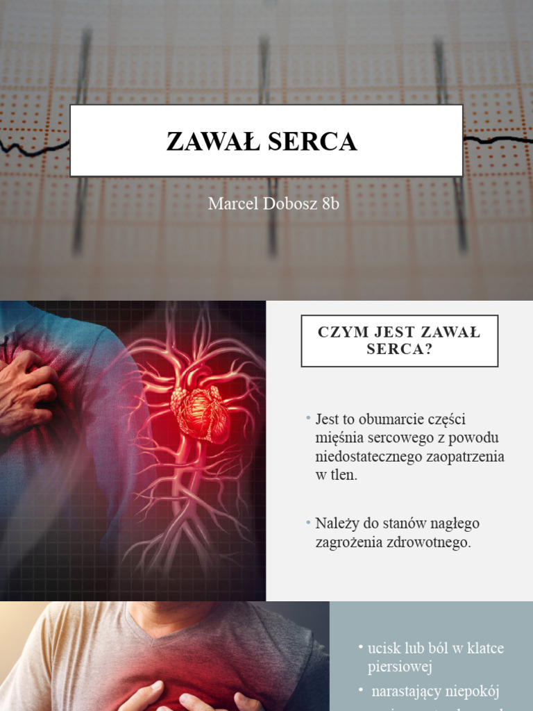 Prezentacja Zawał Serca | PDF