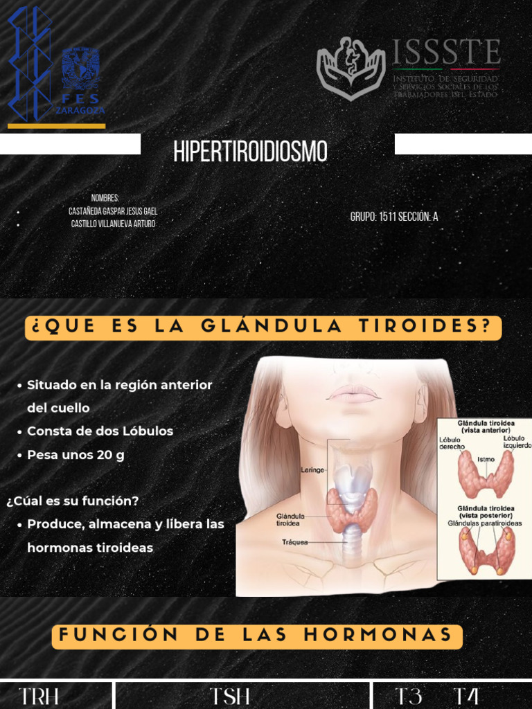 Hipertiroidismo | PDF | Hipertiroidismo | Tiroides