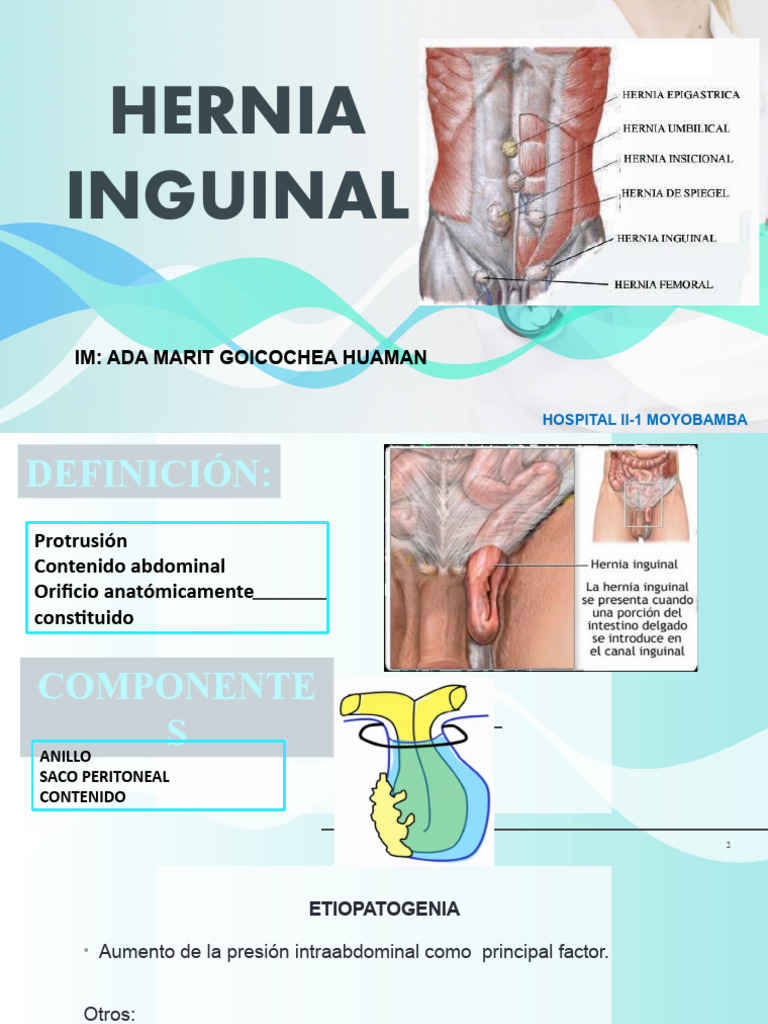 Hernia Inguinal | PDF