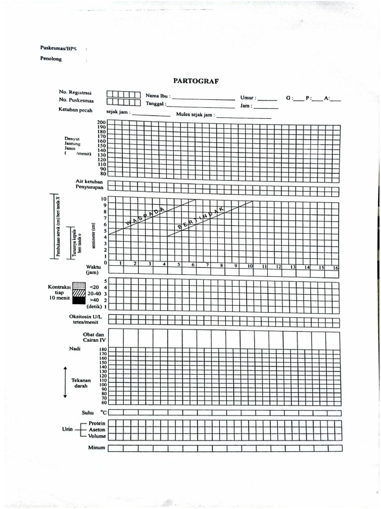 Partograf | PDF