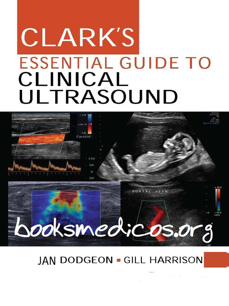 Clarks Essential Guide To Clinical Ultrasound | PDF | Medical Imaging ...
