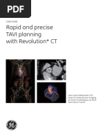 Abnormal Arterial Line Waveforms - Deranged Physiology | PDF | Blood ...
