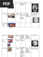 Rhese Method for Orbit X-Ray Positioning | PDF