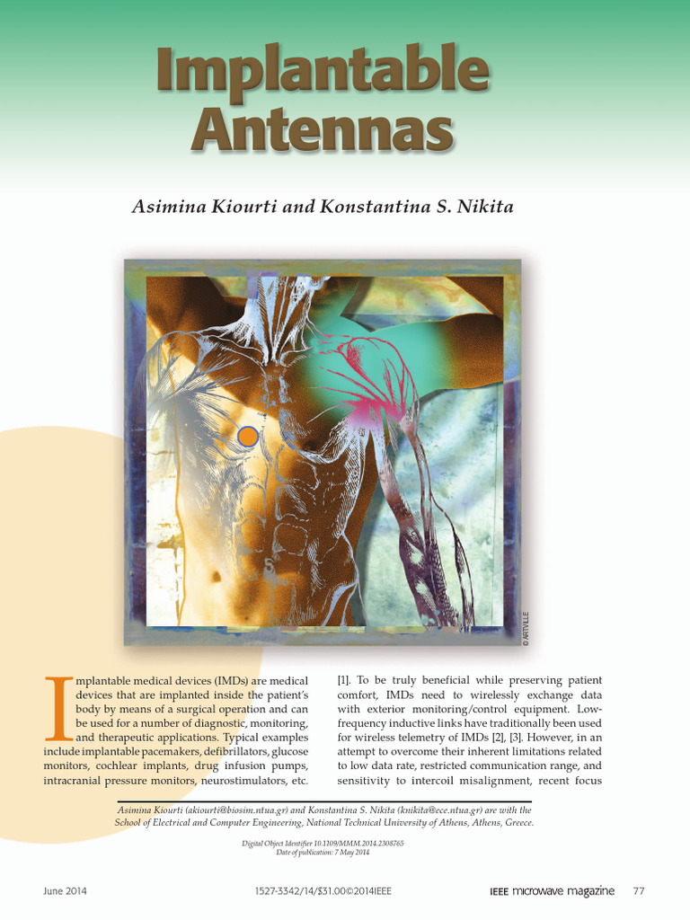 1-Implantable Antennas A Tutorial On Design Fabrication and in Vivo ...