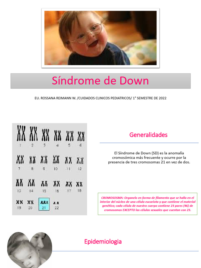 10) Síndrome de Down | PDF | Síndrome de Down | Medicina CLINICA