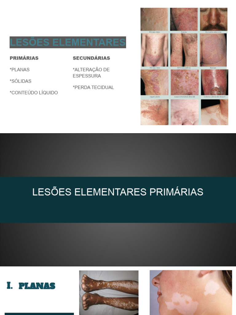 Lesões Elementares Secundárias | PDF