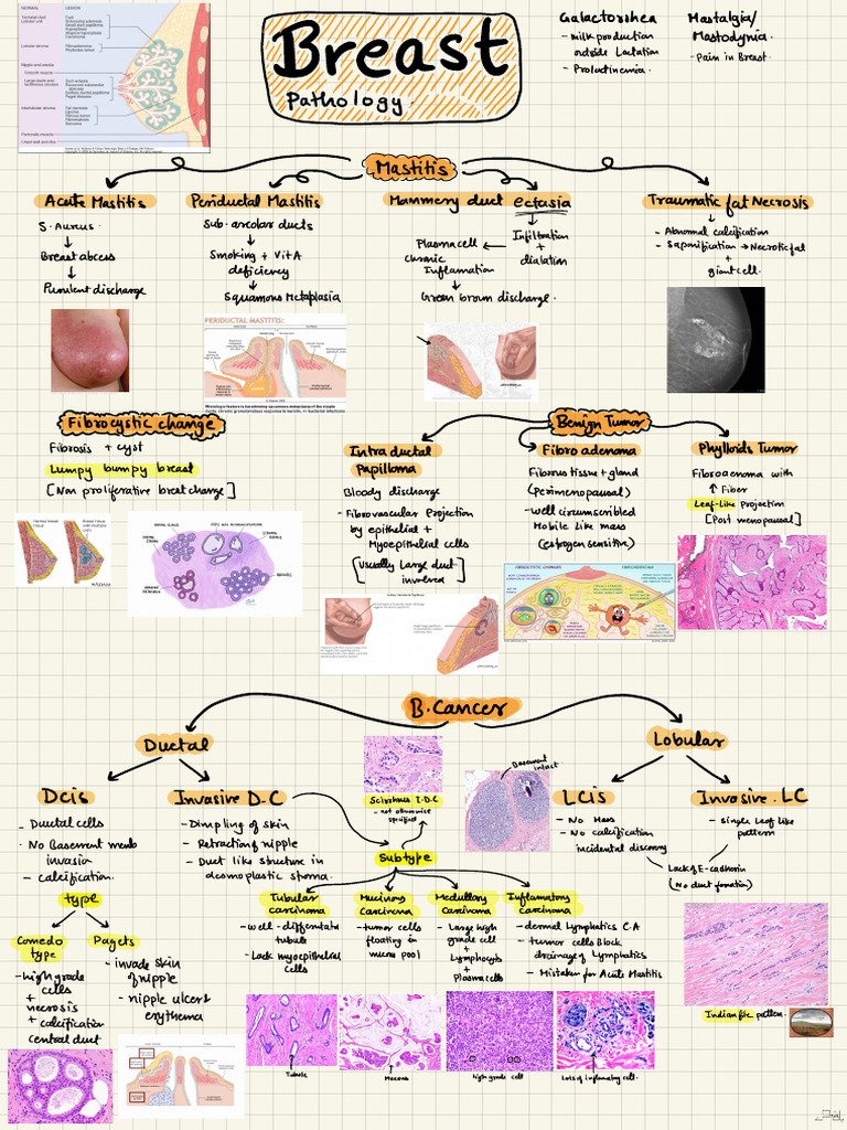 Breast Pathology | PDF | Epithelium | Diseases And Disorders