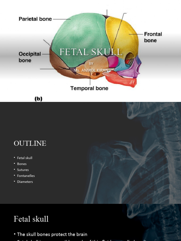 Fetal Skull Anatomy Guide | PDF