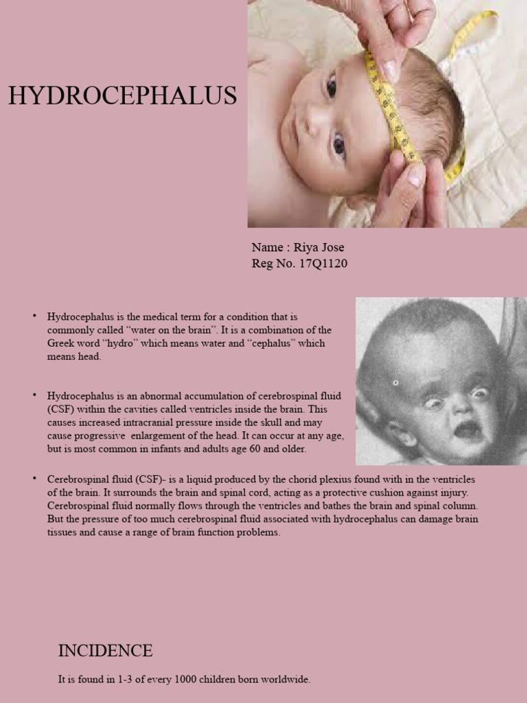 HYDROCEPHALUS | PDF | Cerebrospinal Fluid | Clinical Medicine