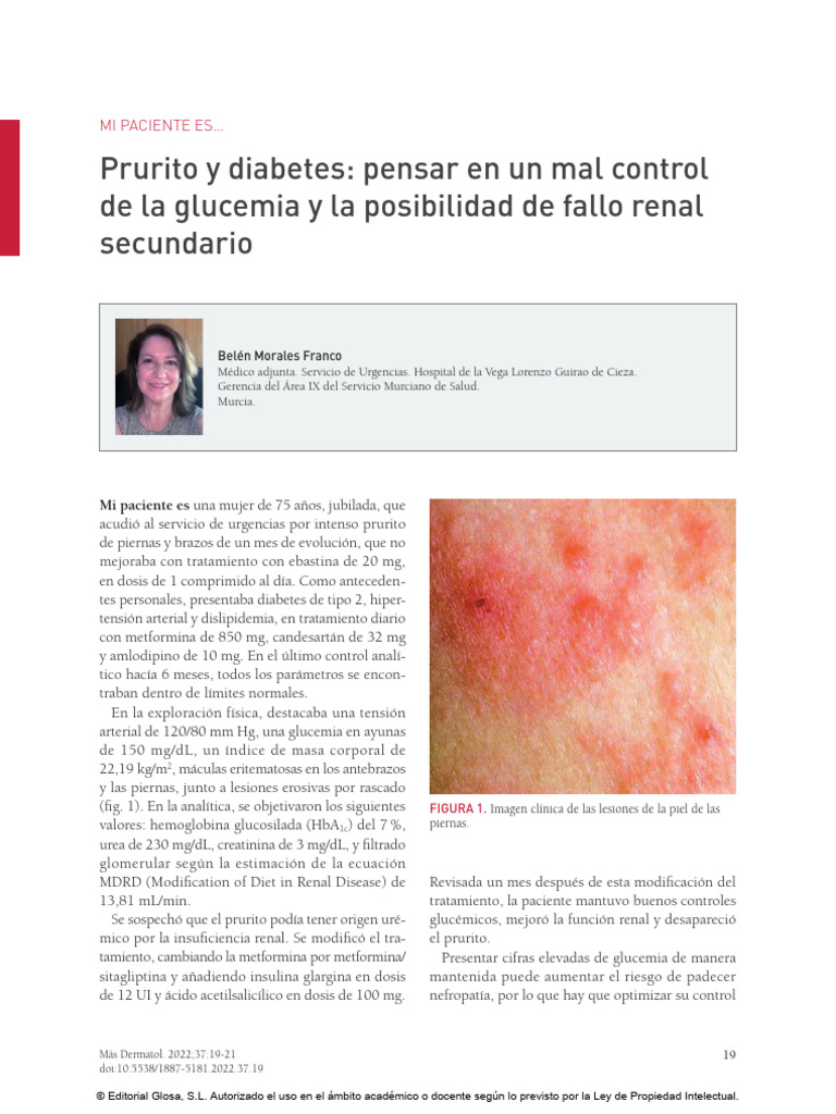 Prurito y Diabetes: Pensar en Un Mal Control de La Glucemia y La ...