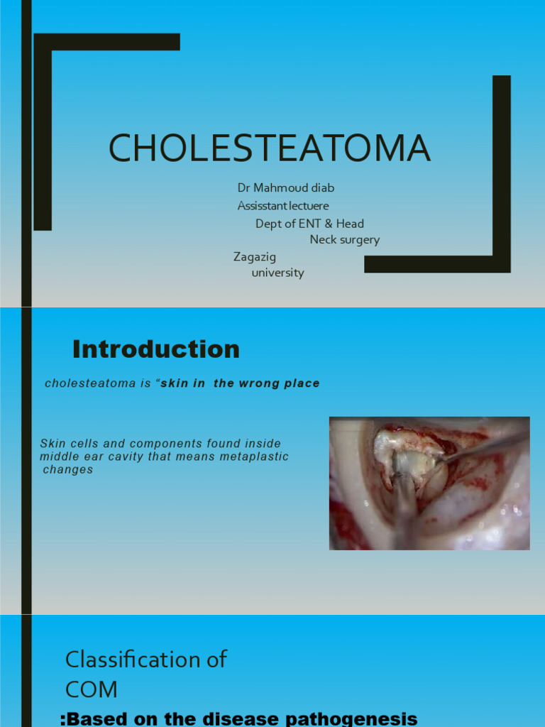 Understanding Cholesteatoma: Types & Treatment | PDF | Human Head And ...