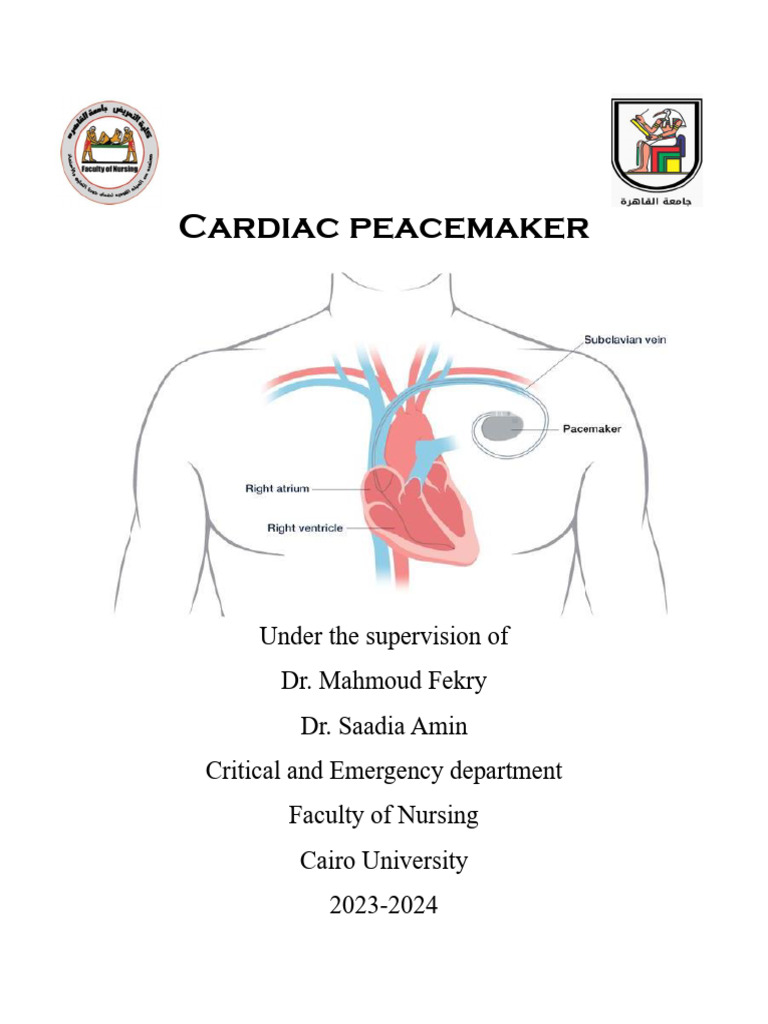 Cardiac Peacemaker | PDF | Artificial Cardiac Pacemaker | Heart