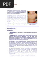 Escarotomía y Escarectomía en Quemaduras | PDF | Quemar | Herida