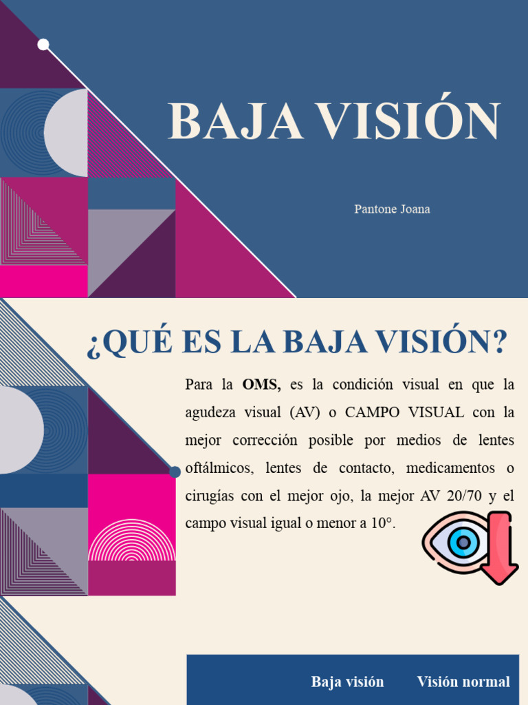 Baja Visión: Causas, Síntomas y Ayudas | PDF | Discapacidad visual ...