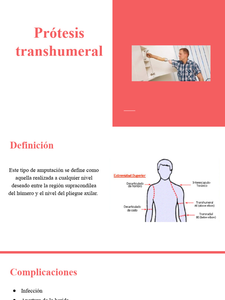 Prótesis Transhumeral | PDF | Hombro | Amputación