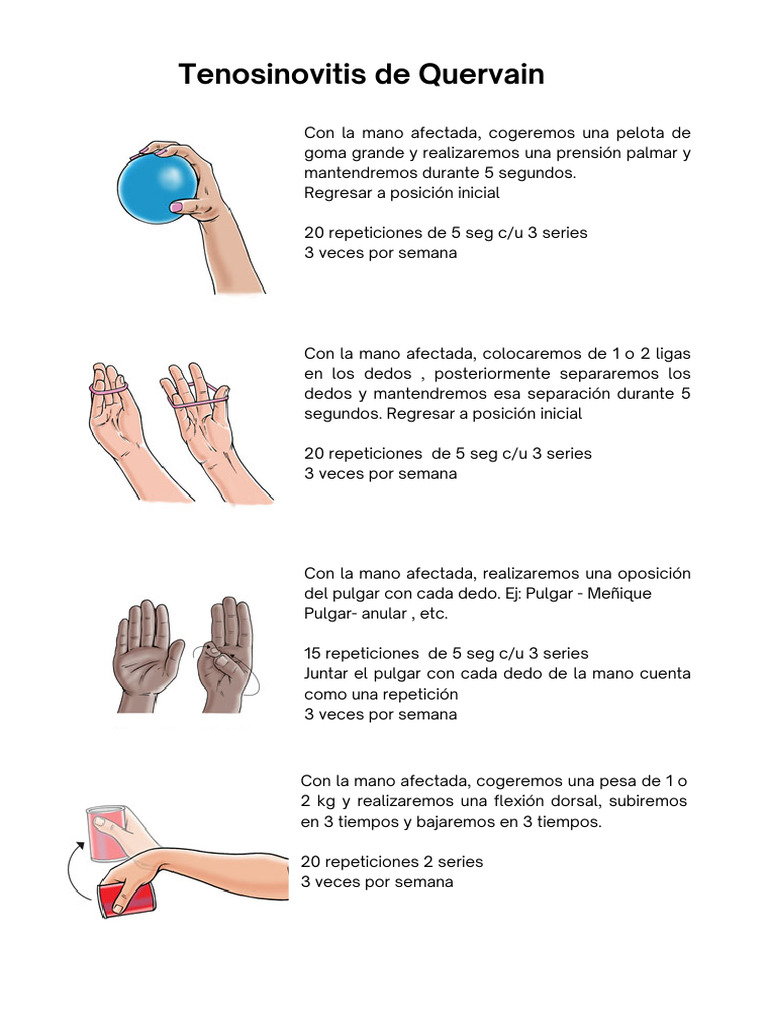 Tenosinovitis de Quervain | PDF | Cocina, comidas y vino | Hogar y jardín